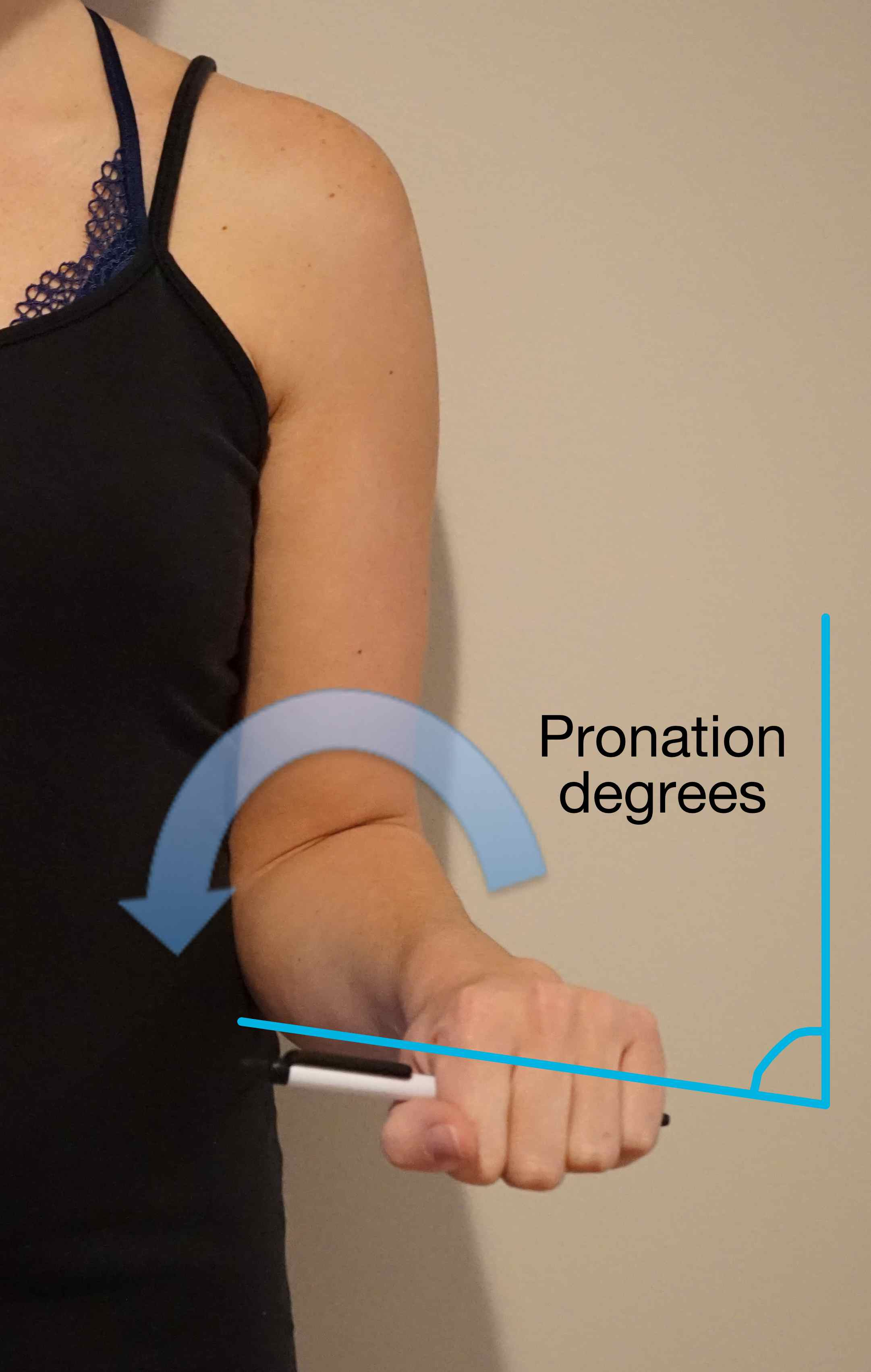 Did you know that the elbow joint is particularly at risk for stiffness ...